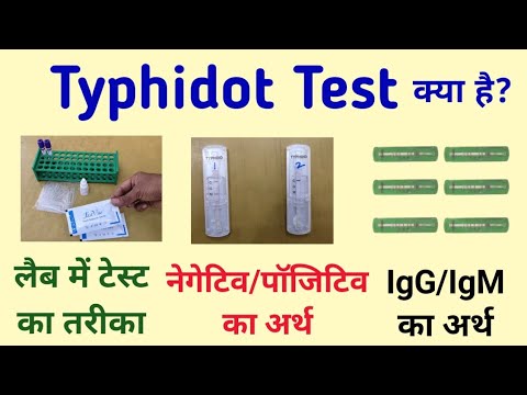 Typhidot test || Typhoid test || typhidot igm igg positive means in ...