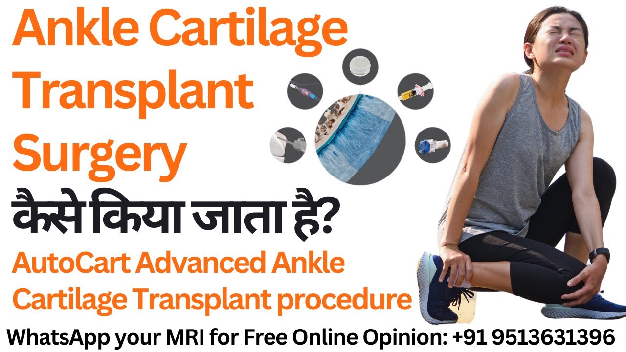Ankle Cartilage Transplant Surgery कैसे किया जाता है? AutoCart Advanced ...