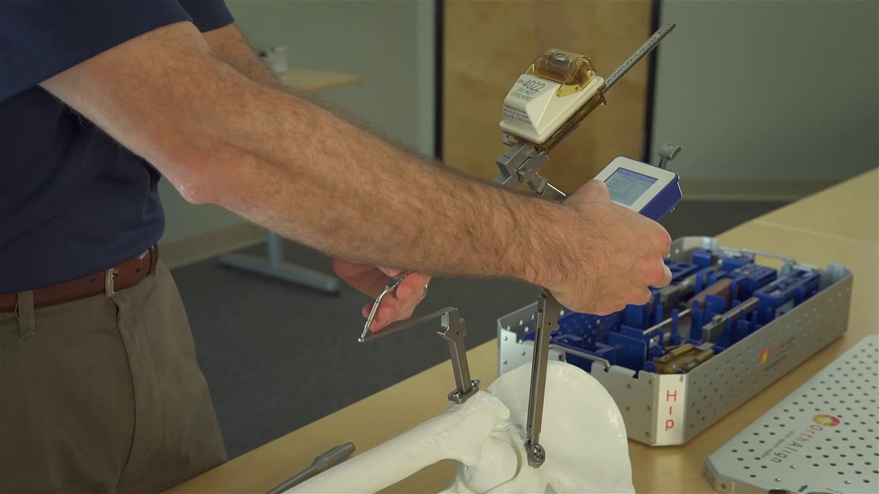 OrthAlign Plus Overview - YouTube