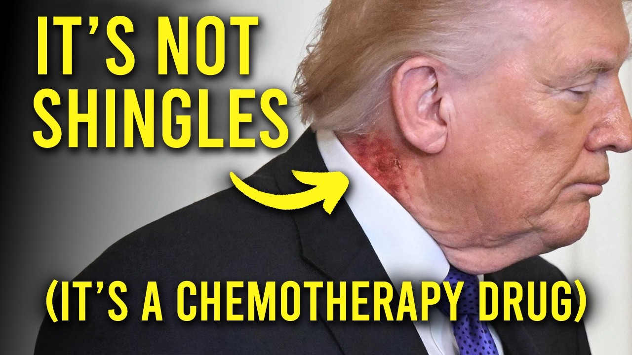 REAL DOCTOR explains Trump's NECK RASH (it's due to a chemotherapy drug ...
