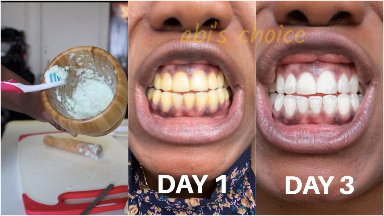 how i whitened my yellow teeth in three min very effective home remedy ...