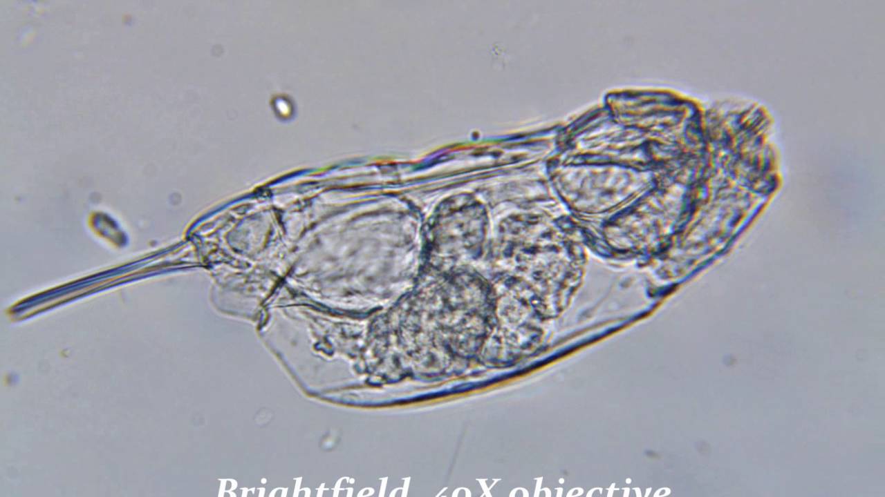 Cephalodella - A Rotifer - YouTube