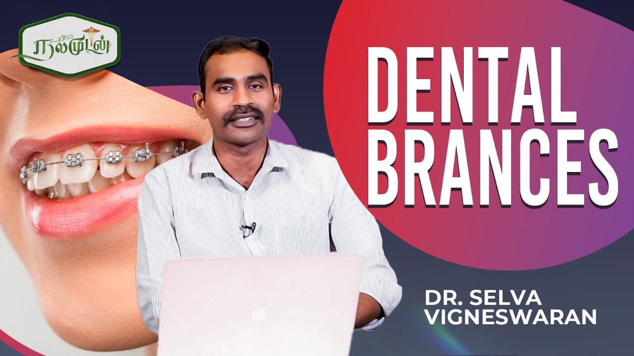 நலமுடன் || Dental Braces || NALLAMUDAN || Dr. Selva Vigneswaran - YouTube
