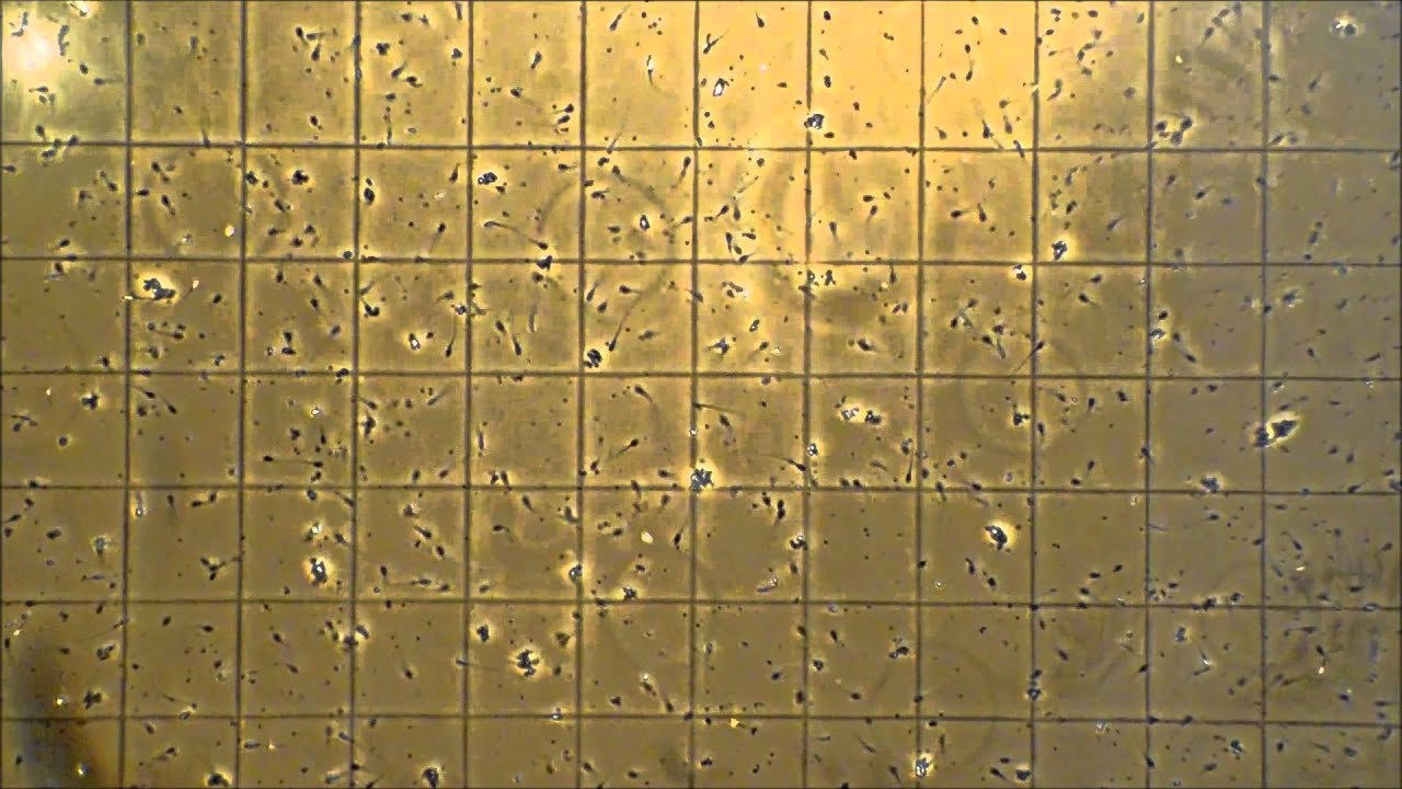 Rabbit sperm analysis for artificial insemination - YouTube
