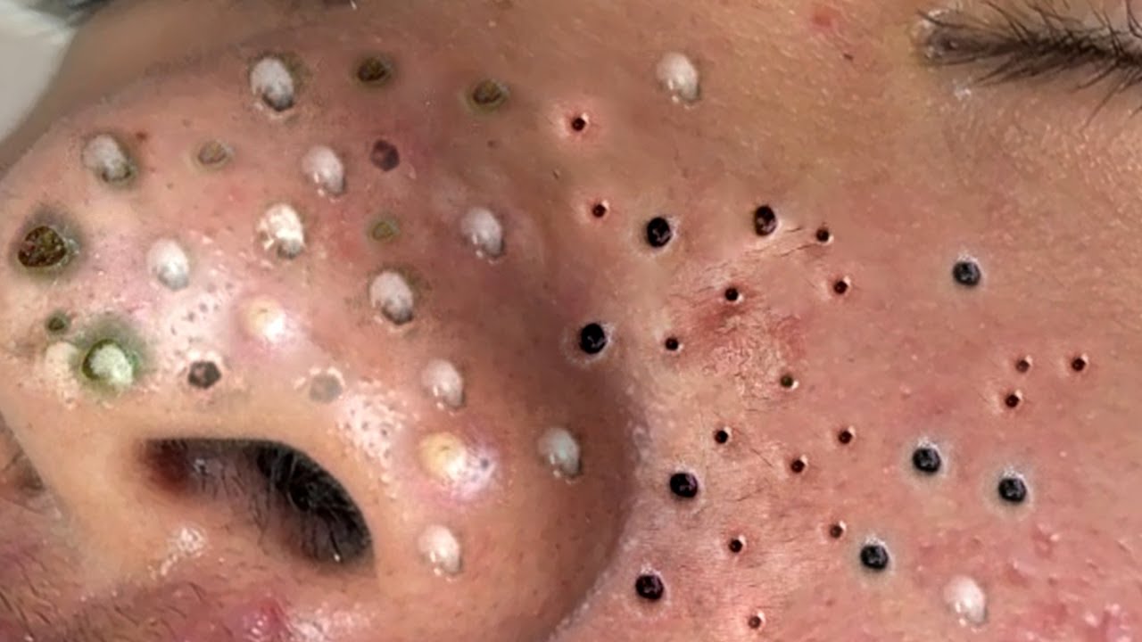 𝐑𝐞𝐟𝐫𝐞𝐬𝐡 𝐘𝐨𝐮𝐫 𝐅𝐚𝐜𝐞 𝐖𝐢𝐭𝐡 𝐒𝐤𝐢𝐧 𝐂𝐚𝐫𝐞 #𝟓𝟑𝟔𝟎173 - YouTube