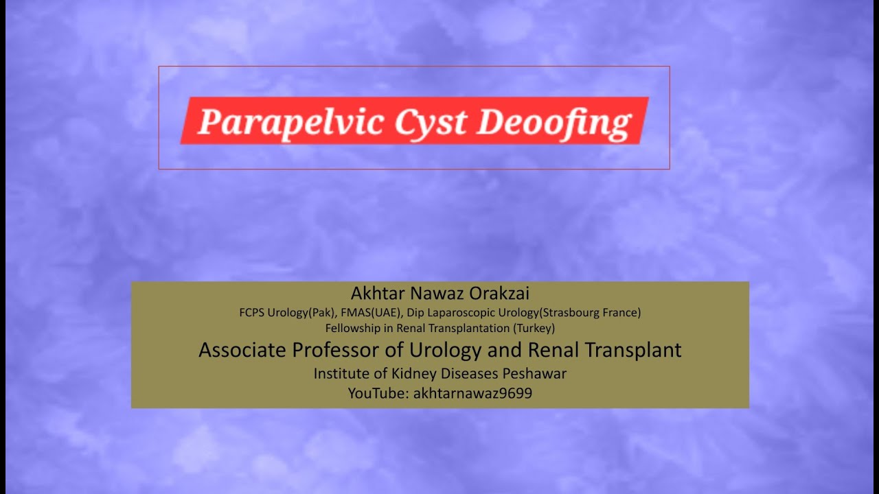 Left Parapelvic Cyst - YouTube
