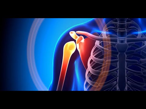 A Case Report on Tuberculosis of Shoulder Joint