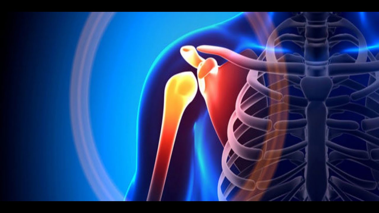 A Case Report on Tuberculosis of Shoulder Joint - YouTube