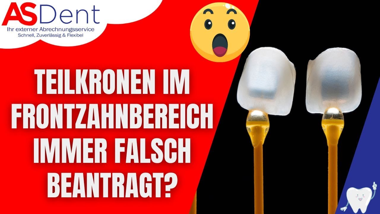 Teilkronen im Frontzahnbereich korrekt beantragen I Zahnärztliche ...