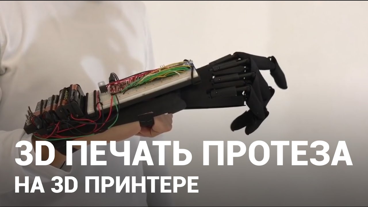 3d печать протеза руки Протез на 3d принтере Youtube