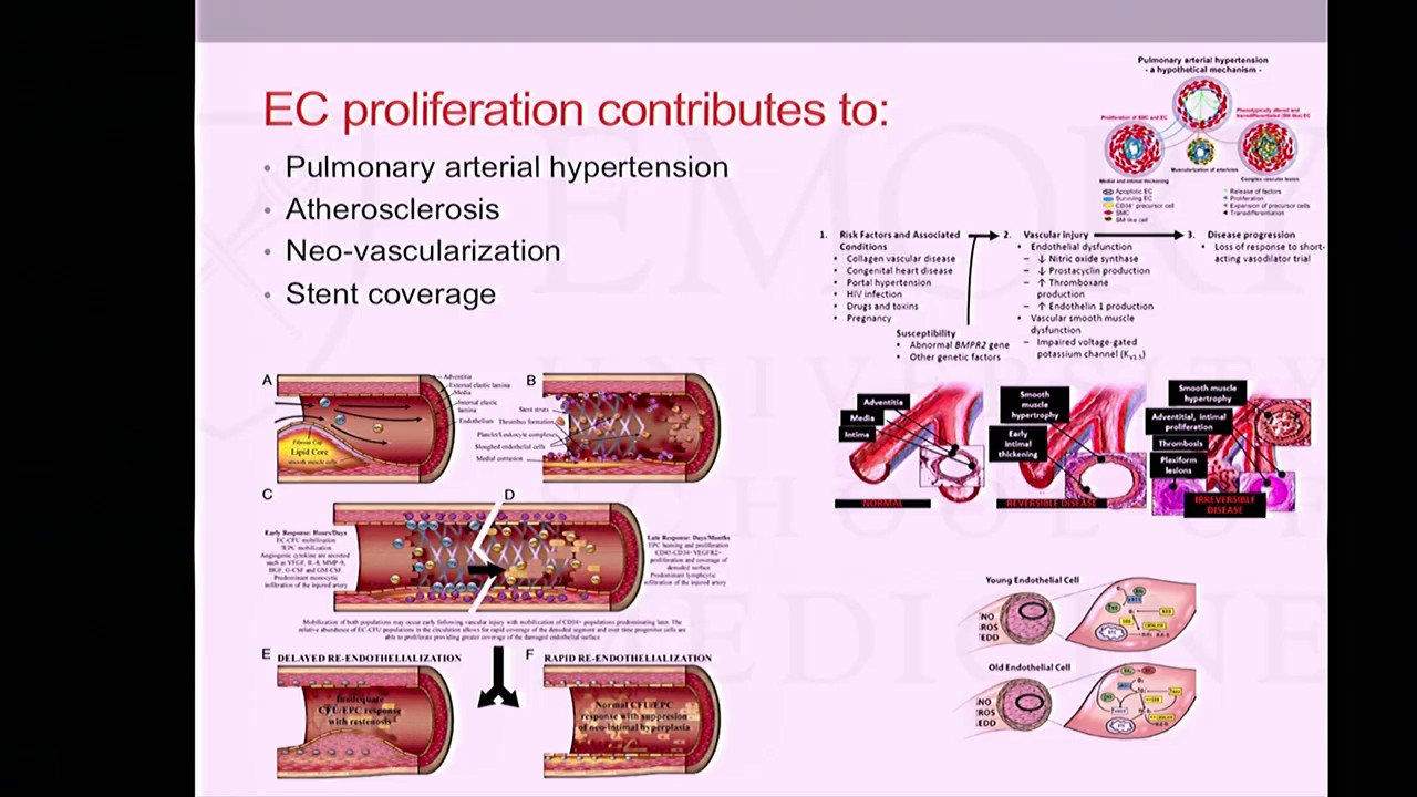 Emory Cardiology Grand Rounds 05-15-2017 - YouTube