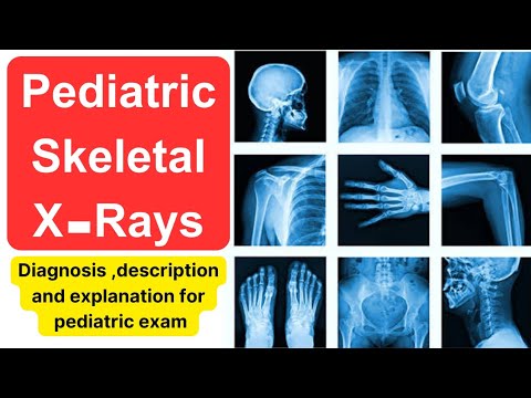 Pediatric important skeletal X-Ray description and diagnosis for ...