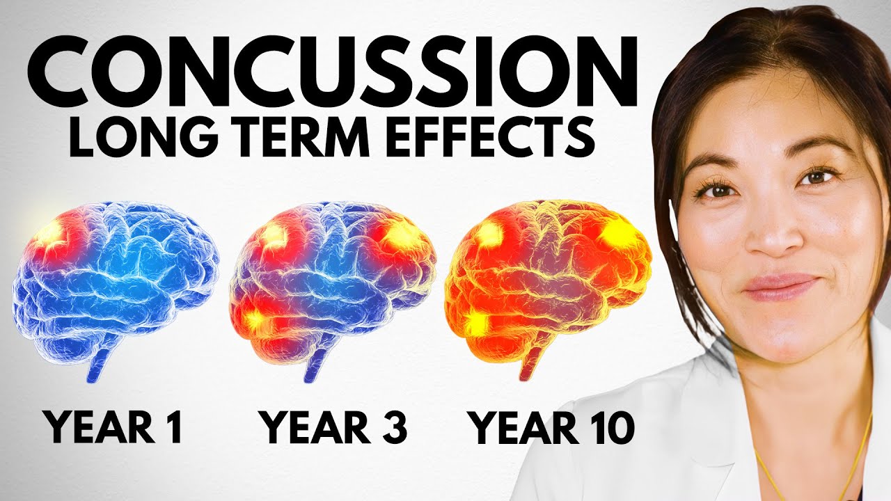 The Truth About Multiple Concussions... Long Term Damage & Recovery ...