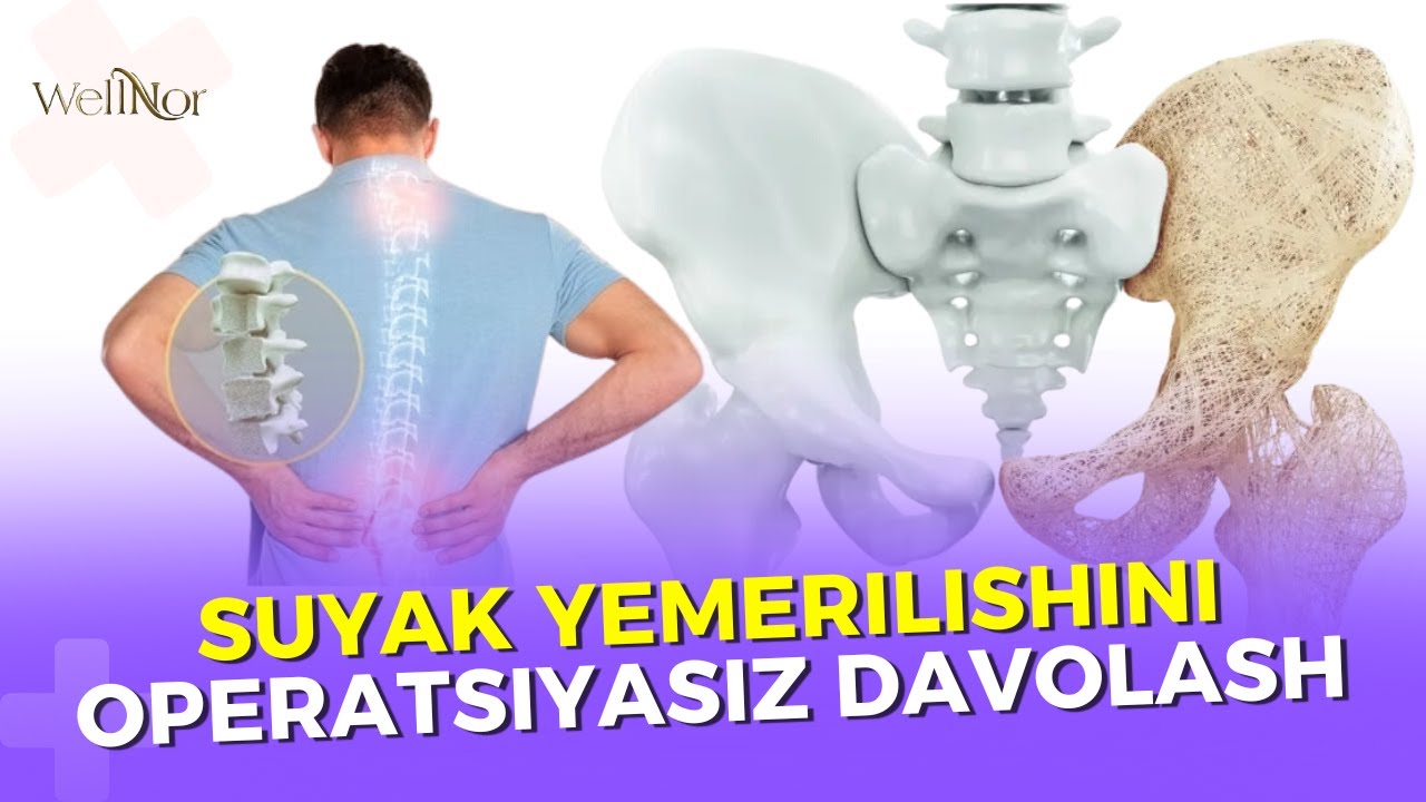 SUYAK YEMIRILISHINI OPERATSIYASIZ DAVOLASH - YouTube