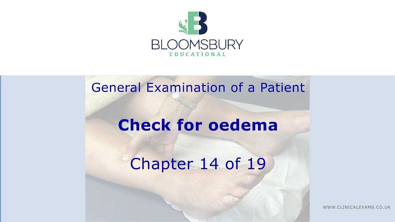 Evaluation of oedema (14) General examination of a patient - YouTube