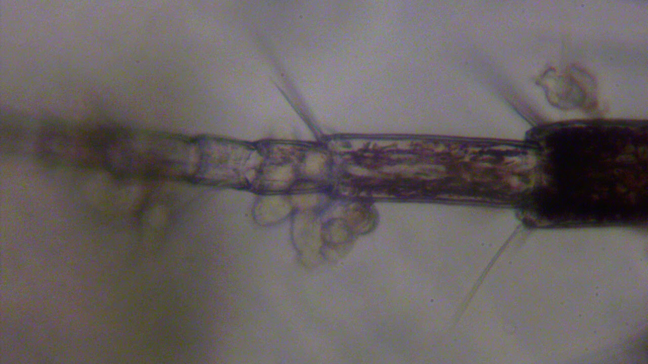 Detail crustacean pot pond Leitz Laborlux 11 x10 obj 111118V1 - YouTube