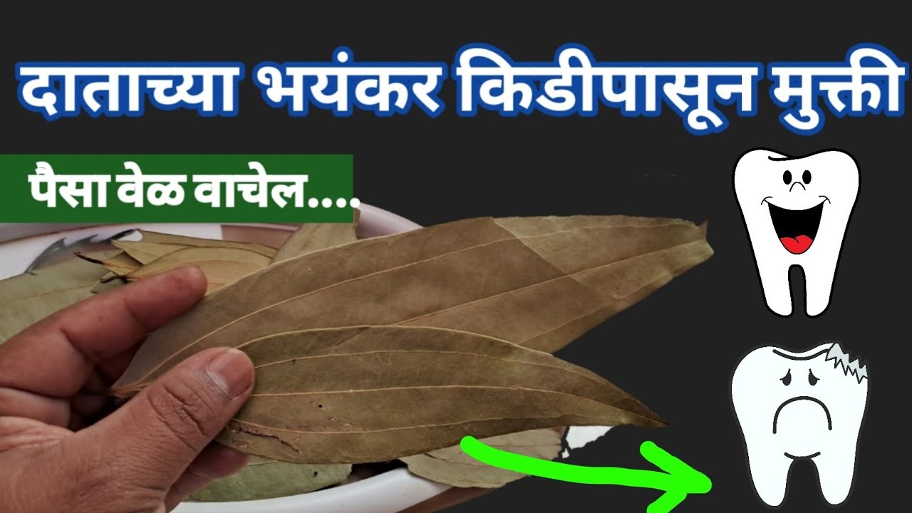 दाताची भयंकर कीड घरी बसल्या दुर करा,datachi kid var ghargutee upaay ...