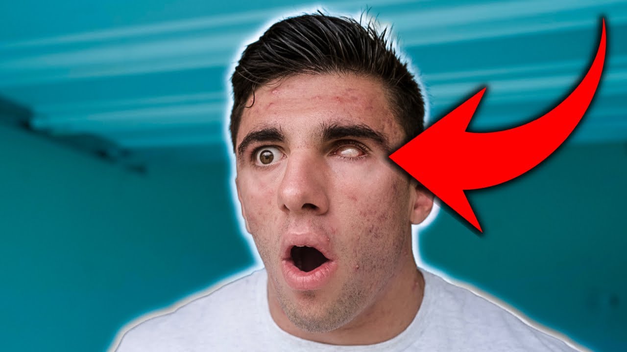 I GOT A NEW FAKE EYE! - YouTube