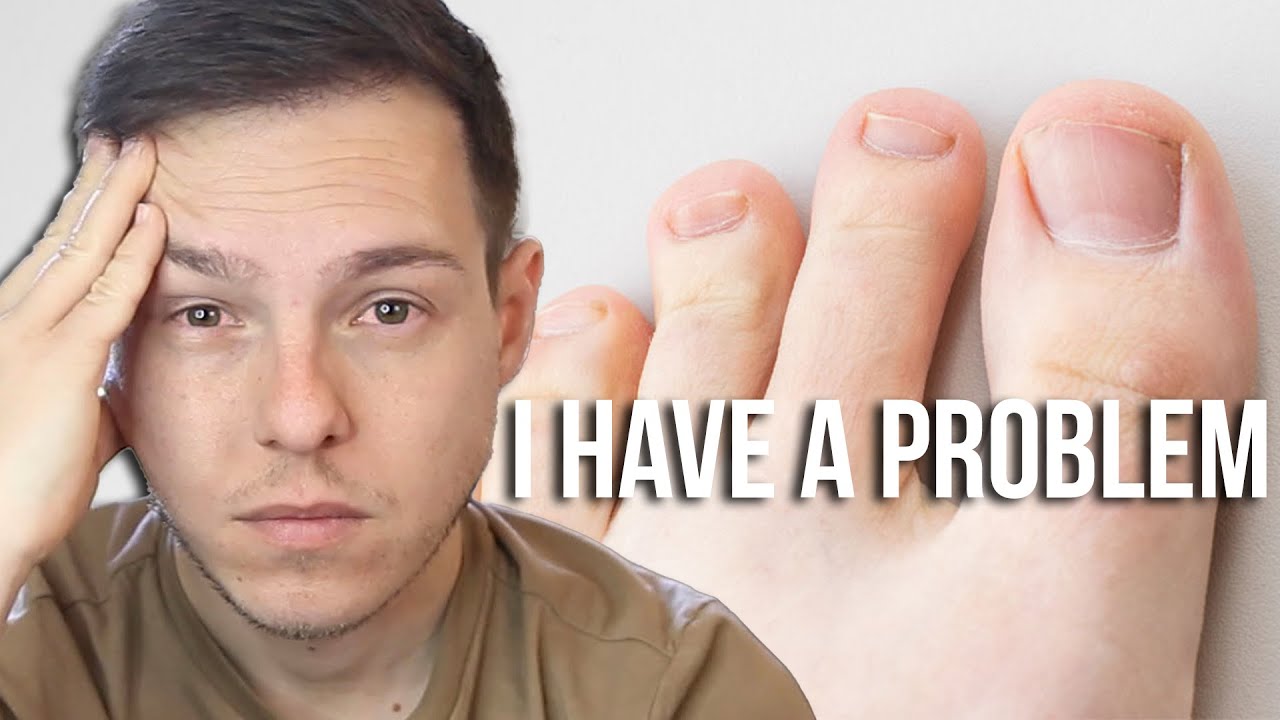 Graham Stephan's DISGUSTING TOENAIL COLLECTION - YouTube