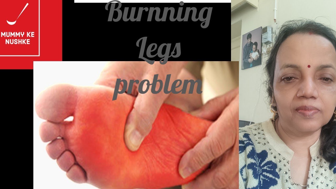 Burning Legs problem/पैरो की जलन का घरेलू उपचार #health - YouTube