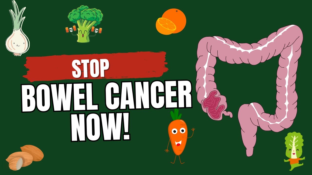 🔥 12 Must-Eat Foods to Beat Bowel Cancer & Colon Polyps! 💪 Your Gut ...