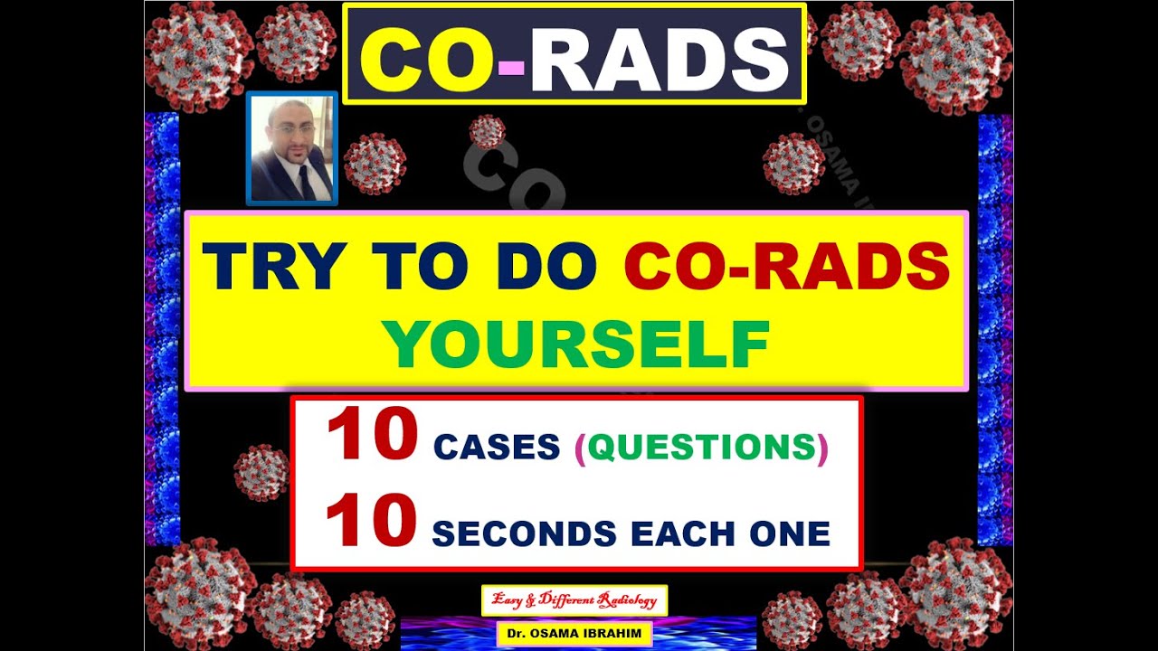 Try to do CO RADS score yourself; for proper and early diagnosis of ...
