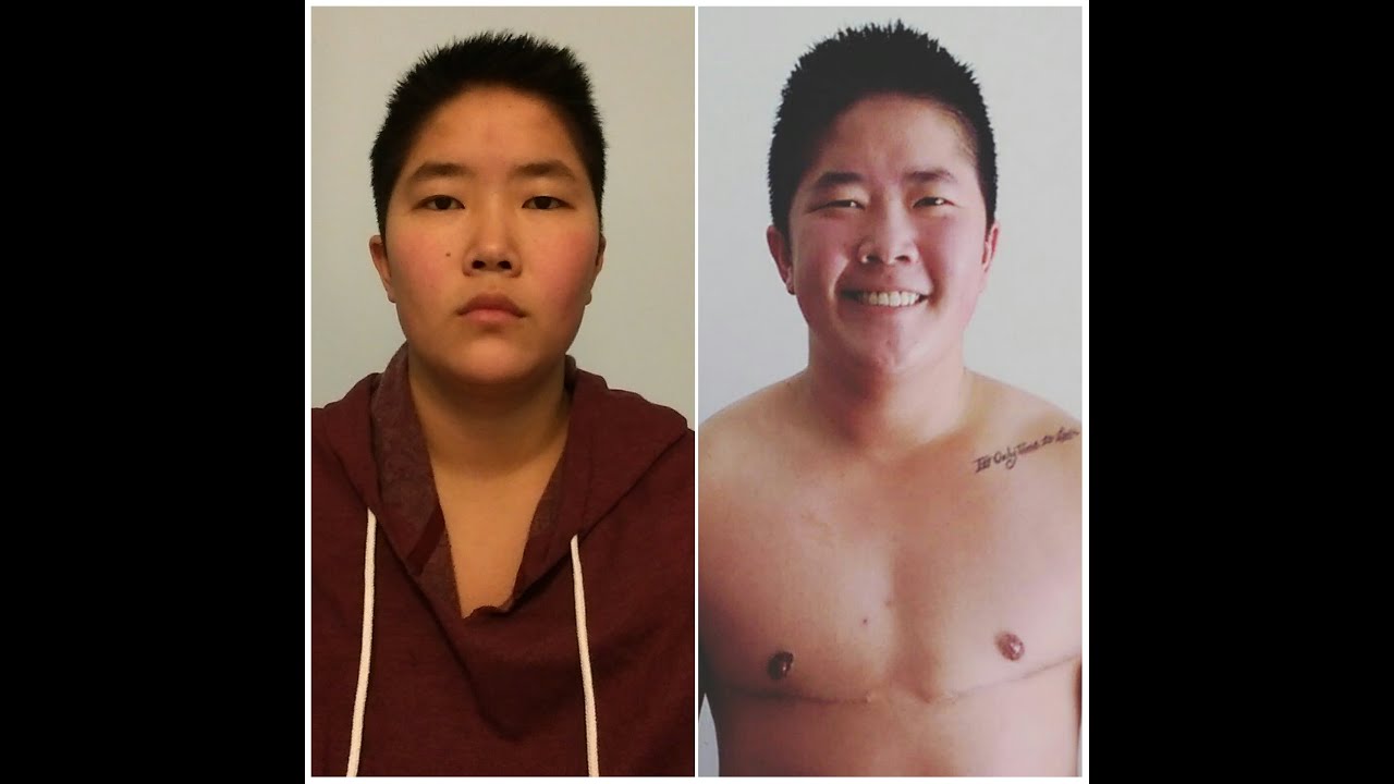 One Year on Testosterone: FTM Transition - YouTube