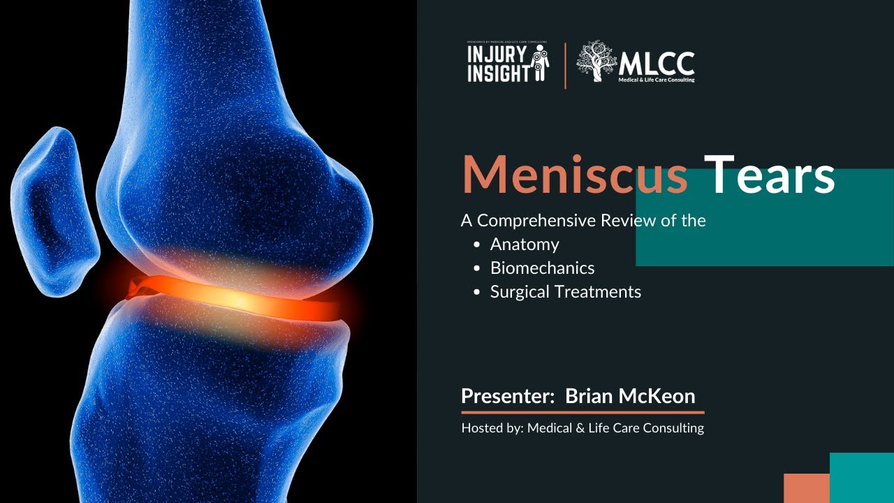 Meniscus Tears: A Comprehensive Review of the Anatomy, Biomechanics ...