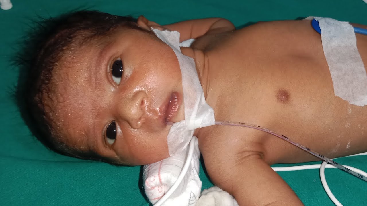 Normal Delivery New Born baby | Normal Delivery In 8month..#viralvideo ...