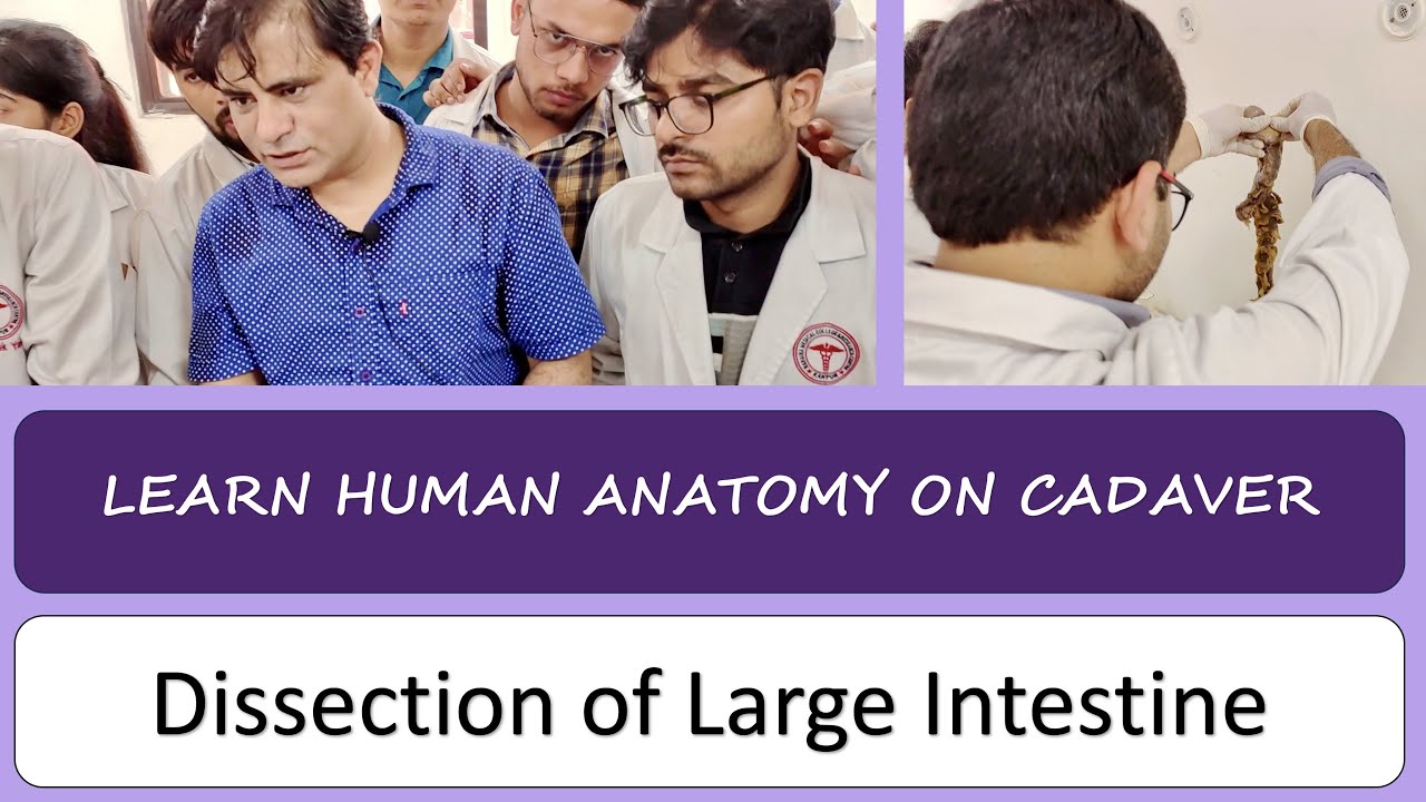 Dissection of large intestine, Dissection of caecum, transverse colon ...