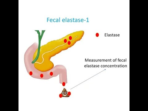 fecal elastase enzyme test; Definition, Purpose, Procedure, Analysis ...
