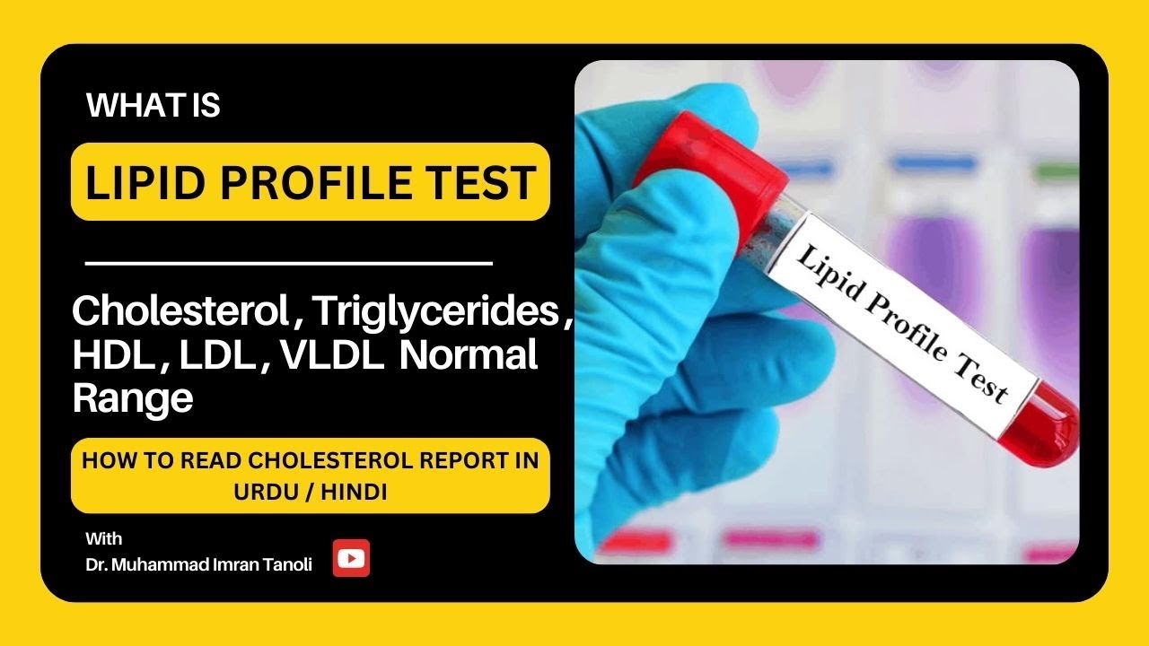 Lipid Profile Test in Urdu || Lipid Profile test Kya Hota Hai || Lipid ...