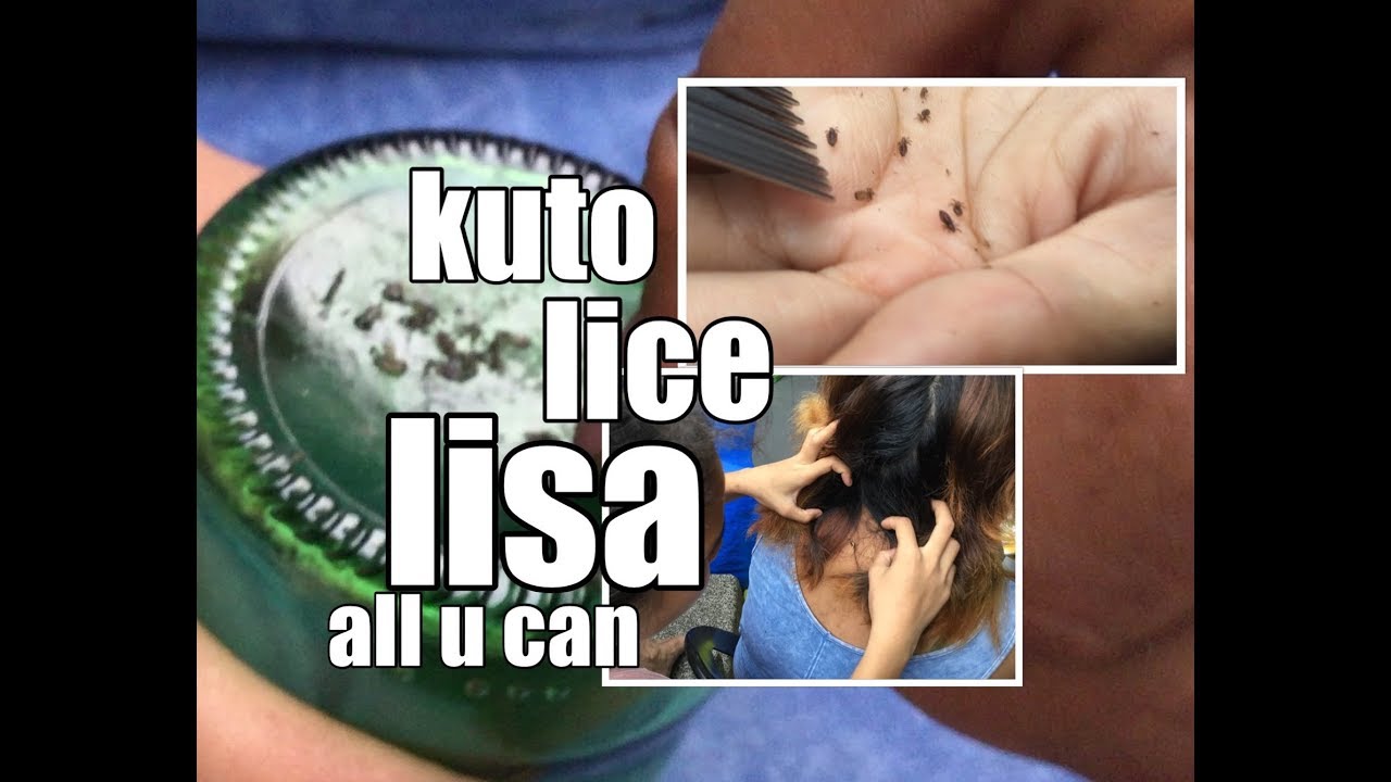 Lice all you can 🐜 Kuto Kutoon🐜🕷🕸 Lisa unli🐜🕸 - YouTube