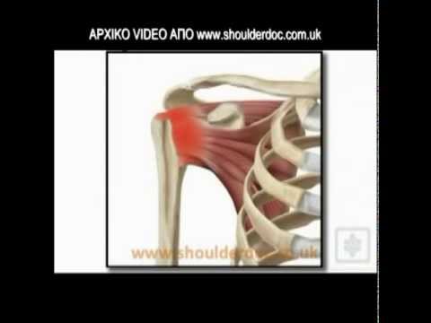 ΣΥΝΔΡΟΜΟ ΥΠΑΚΡΩΜΙΑΚΗΣ ΠΡΟΣΤΡΙΒΗΣ - YouTube