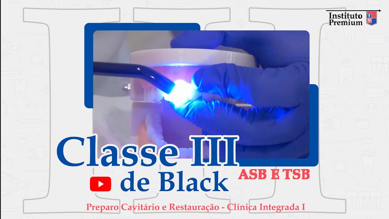 PREPARO CAVITÁRIO E RESTAURAÇÃO #3 - Instituto Premium 🦷 - YouTube