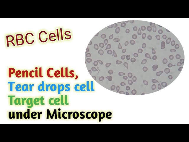 Tear Drop Cells