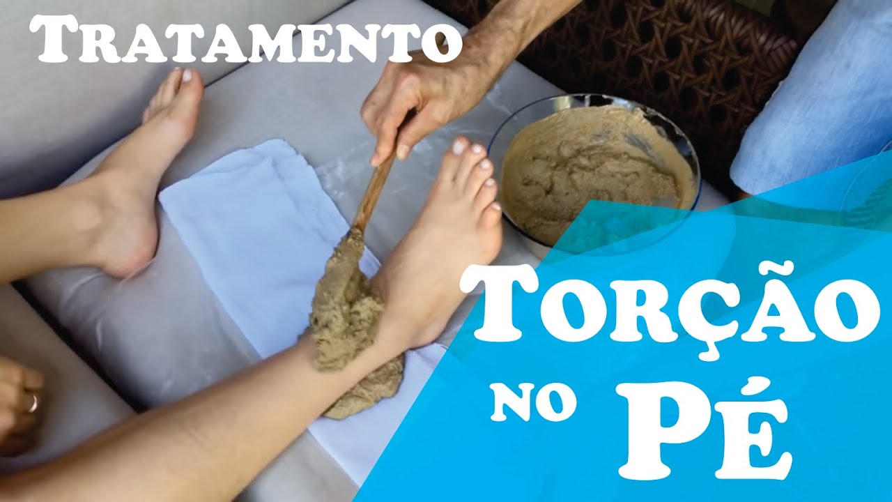Como RECUPERAR uma torção de pé de maneira NATURAL?? - YouTube