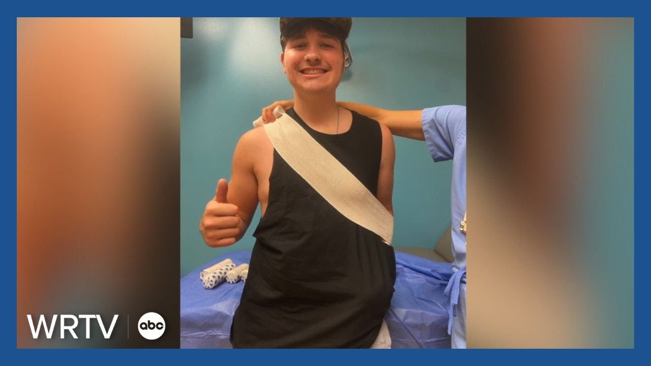 Indiana teen advocates for firework safety after accident - YouTube