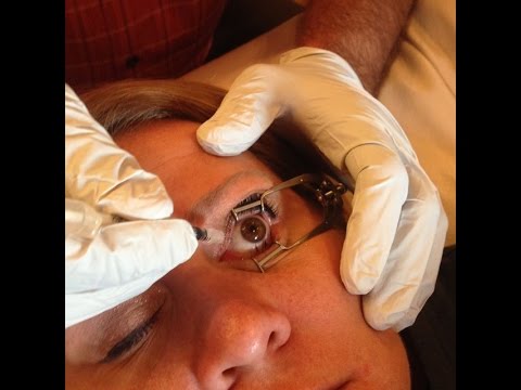 Watergate of Eye Care! Injections for wet macular degeneration - YouTube