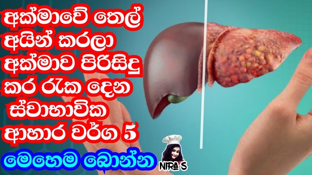 අක්මාව පිරිසිදු කරන ස්වභාවික ආහාර 5ක් | කොලෙස්ටරෝල් දියවැඩියාවට වලට ...