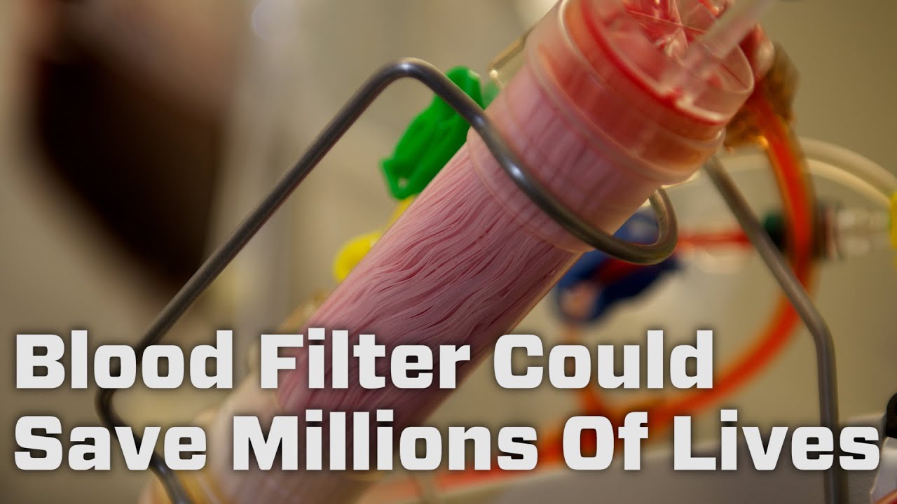 Blood Filter Could Save Millions Of Lives - YouTube