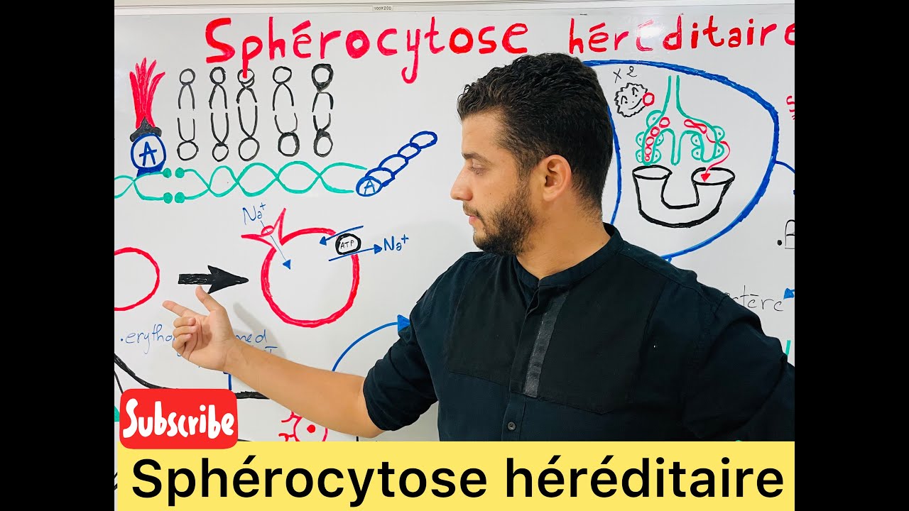 Sphérocytose héréditaire - YouTube