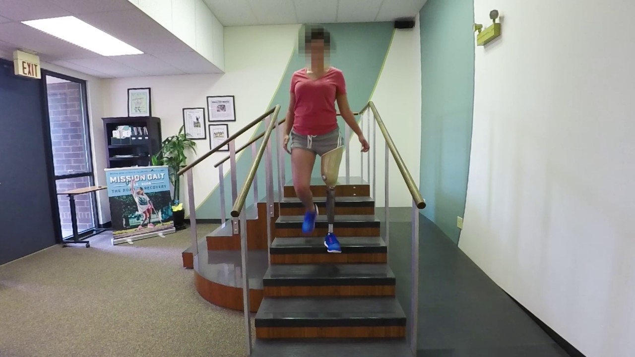 Stair Navigation - Above Knee Amputee (C-Leg) - YouTube