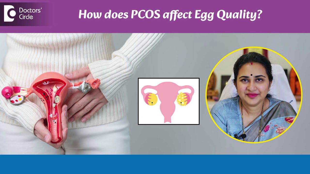 How does #pcos affect Egg Quality? How to Calculate OVULATION Date ...