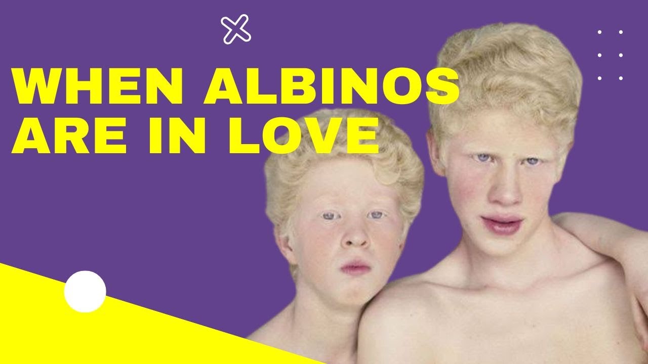 Albinos in Love: An Unexpected Wedding Story - YouTube