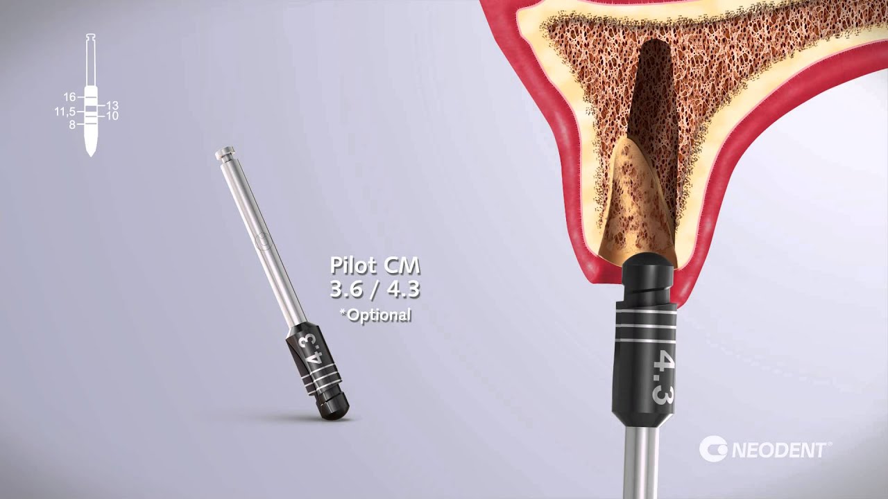 CM Alvim Installation Sequence - YouTube