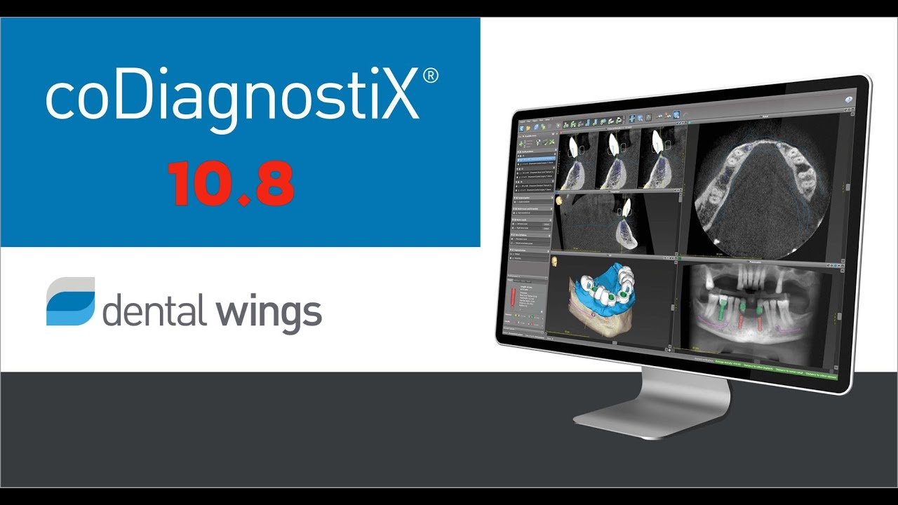 coDiagnostiX 10.8 || 2024 || - YouTube