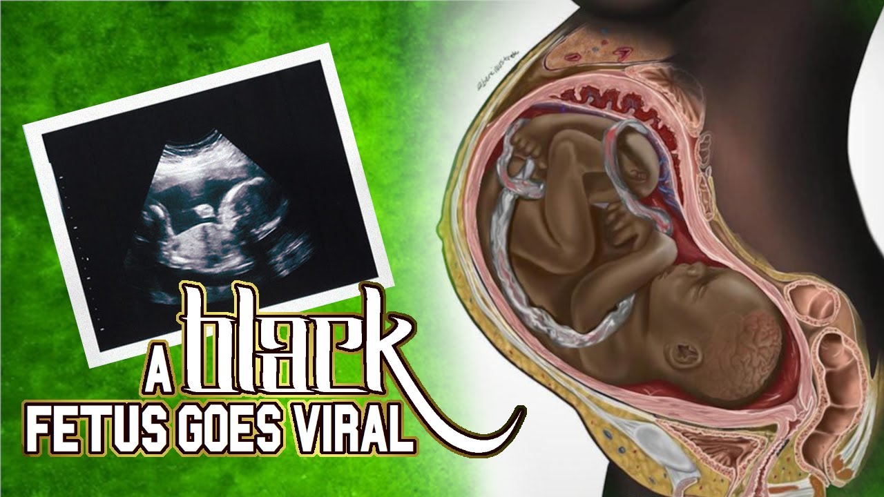 Black Fetus Goes Viral And Shines A Light On The Need For Diversity In ...