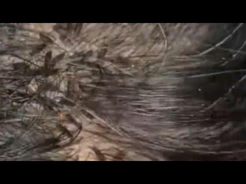 Merab remove the lice of yashfa hair#insects#lice - YouTube