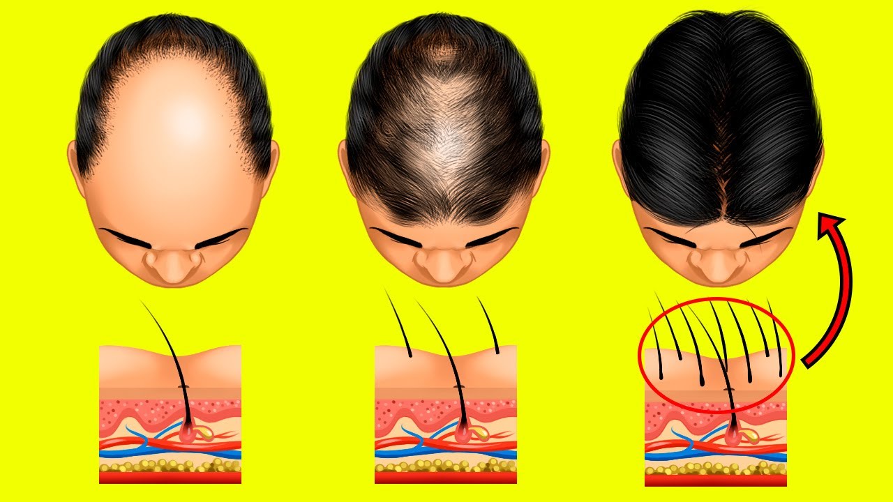 15 hábitos que te darán un cabello más fuerte, saludable y más ...